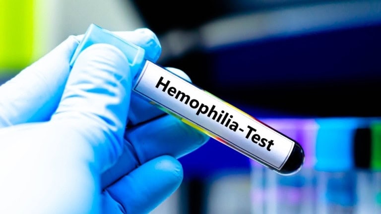 Hemofilia: significado, causas, consecuencias y tipos | UNIR